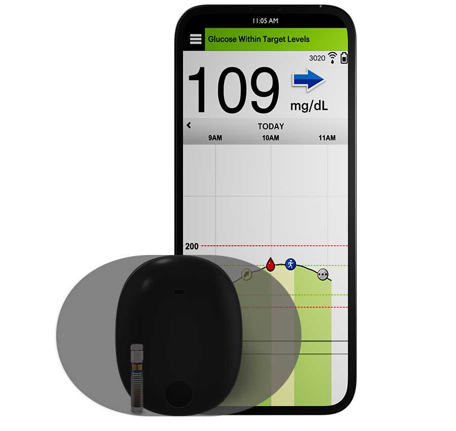 Eversense Glucose Monitoring (CGM) Diabetes System Designed to Fit Your ...